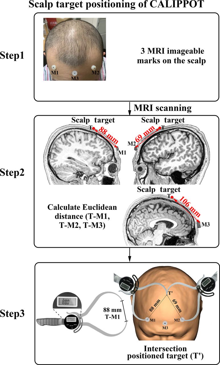 Caliper-based precise positioning of the target (CALIPPOT) for ...