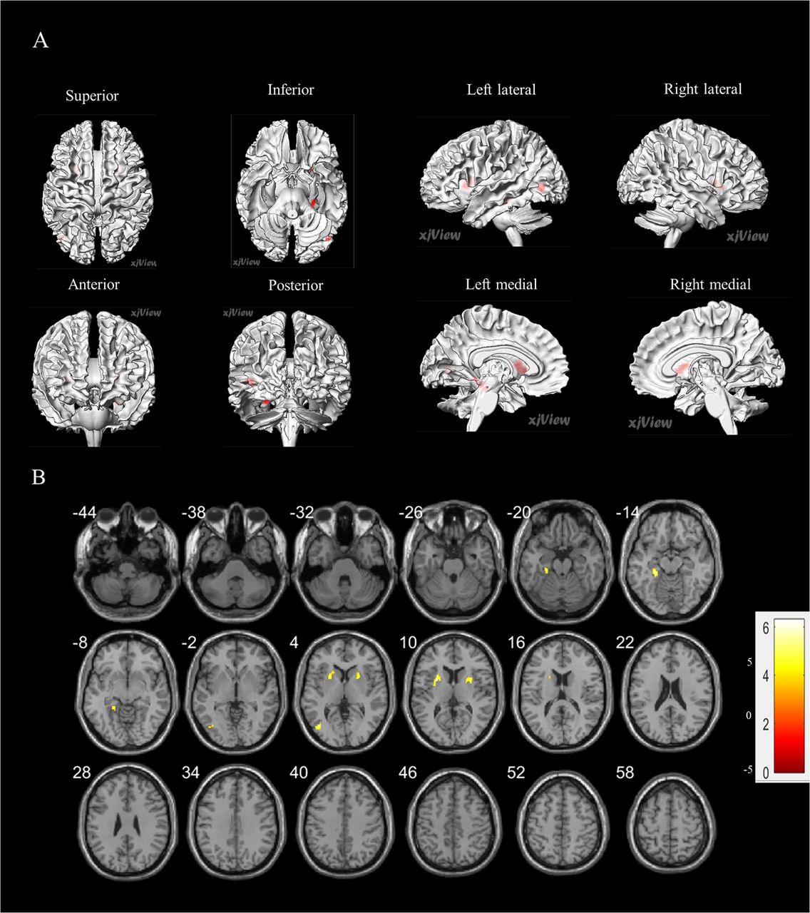 Lower synaptic density and its association with cognitive dysfunction ...